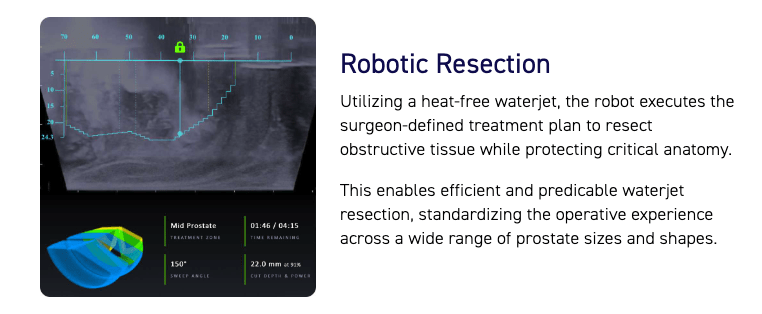 Procept BioRobotics: Risk Capital Unlock With FDA Hydros Approval ...