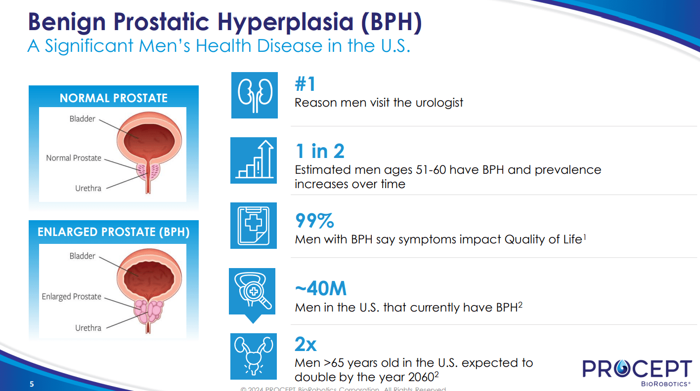 Procept BioRobotics Stock: Hydros Aquablation System Fuel Next Leg of ...