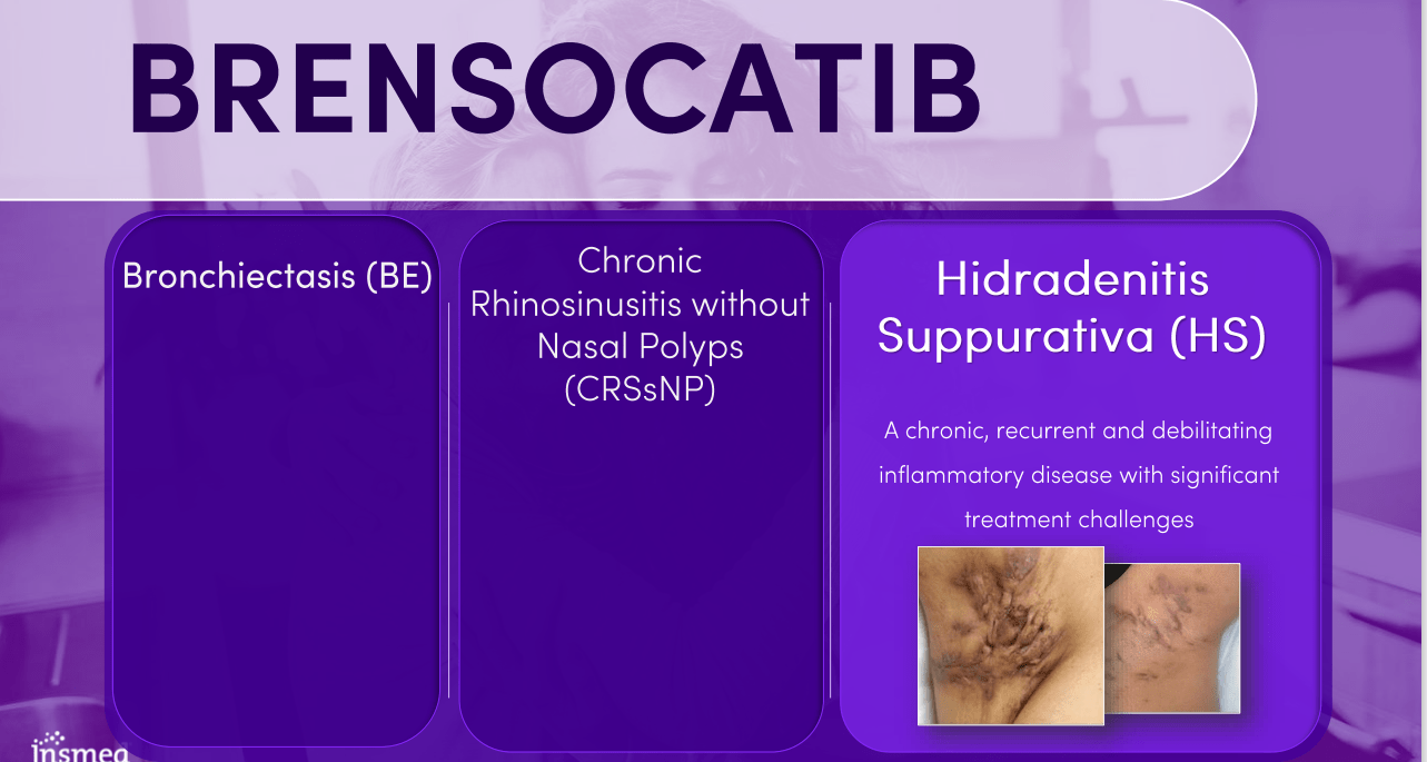 Insmed Incorporated: Now Comes The Hard Part (NASDAQ:INSM) | Seeking Alpha