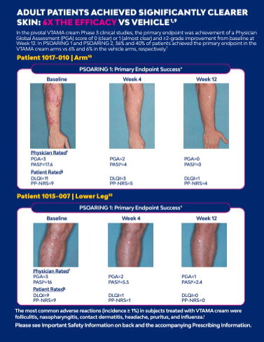 Roivant's Sale Of Dermavant To Organon: Win-Win In Atopic Dermatitis ...