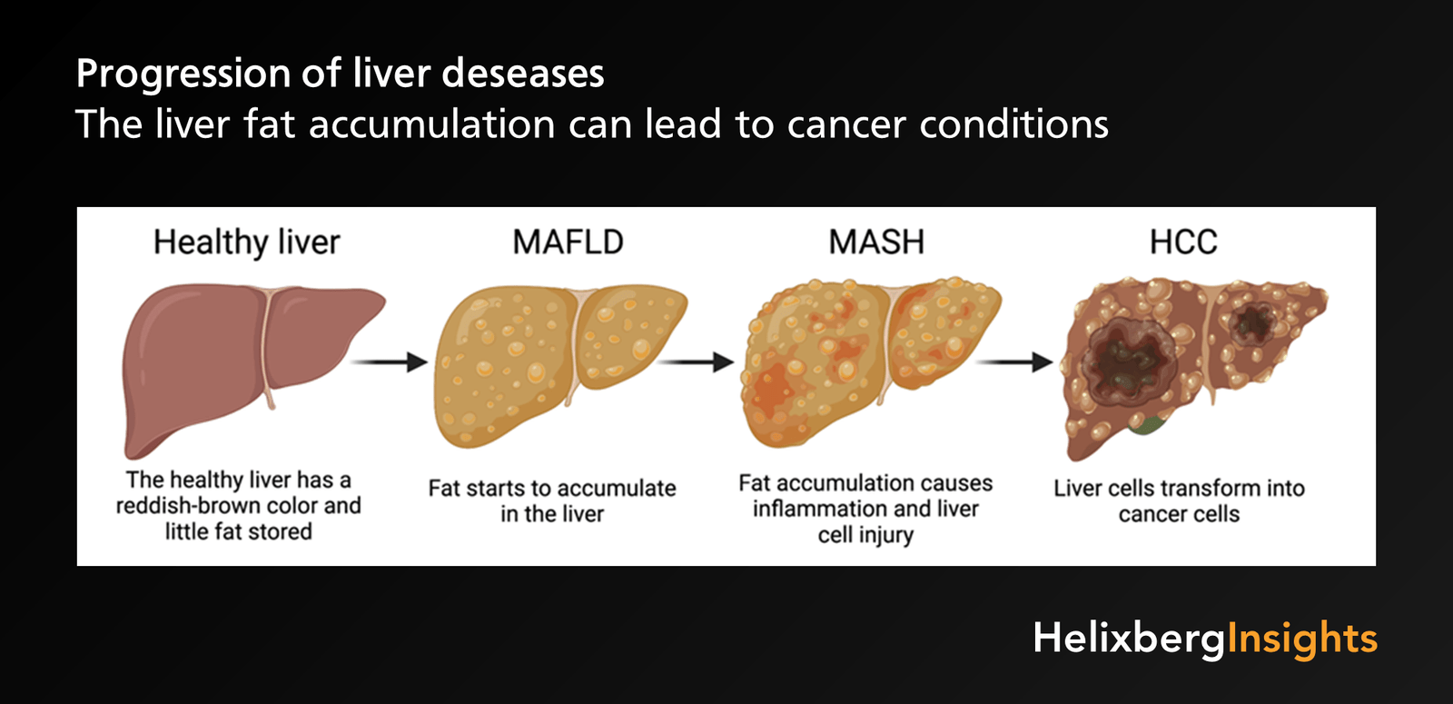 Altimmune's Catalytic Moment In 2025: Pemvidutide's Phase 2b Trial In ...