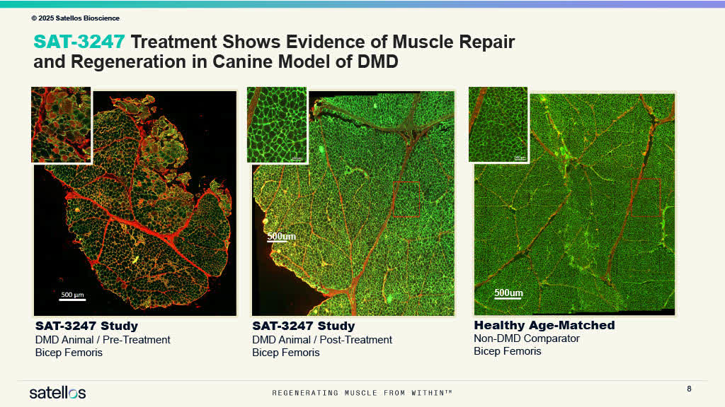 Satellos Bioscience: Promising Novel Treatment For Duchenne Muscular Dystrophy (TSX:MSCL:CA ...