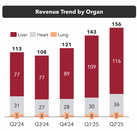 TransMedics: Just Like The CEO, I'm Buying (NASDAQ:TMDX) | Seeking Alpha