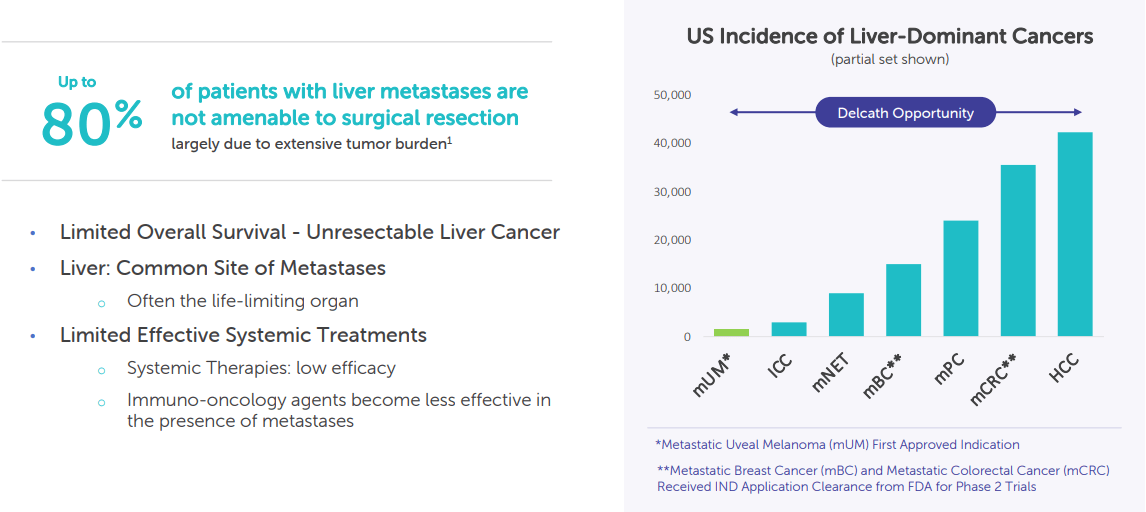 Delcath Systems: Huge Potential But With The Handbrake On For Now ...