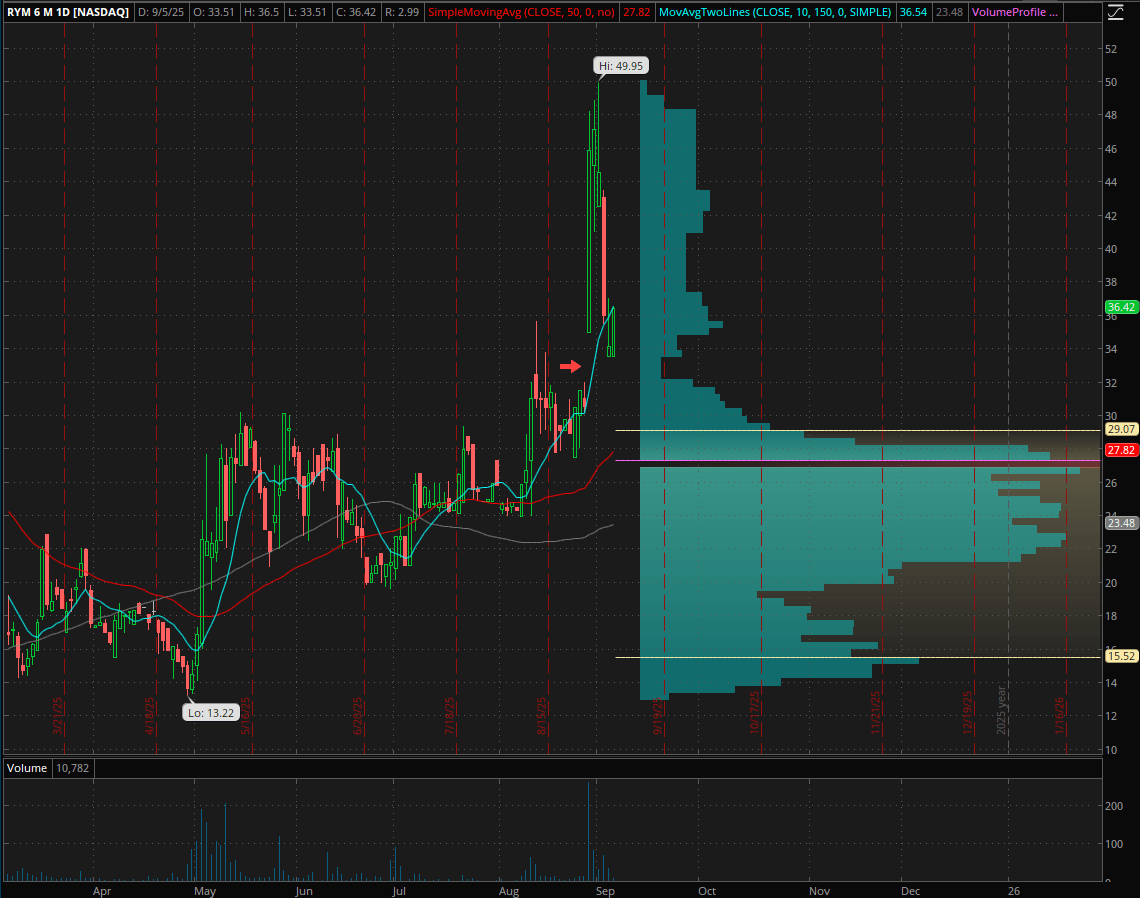 Avoid RYTHM, Inc. For Now (NASDAQ:RYM) | Seeking Alpha
