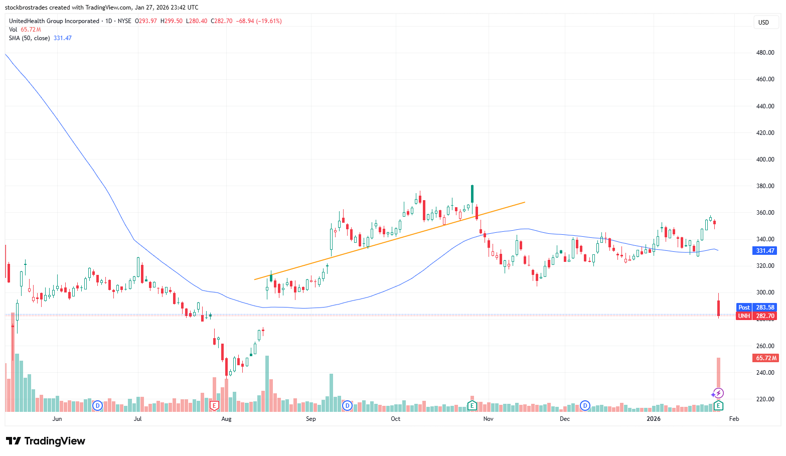 UnitedHealth Stock: Buying The Dip Could Be A Trap (NYSE:UNH) | Seeking ...