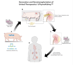 United Therapeutics: In Progress -- New Organs For Old At Scale (NASDAQ ...