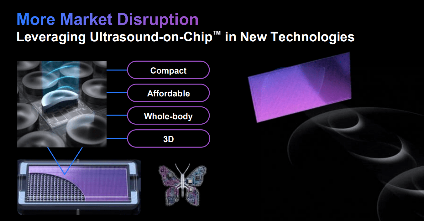 Butterfly Network: Ultrasound-On-Chip And AI Could Create Computer ...