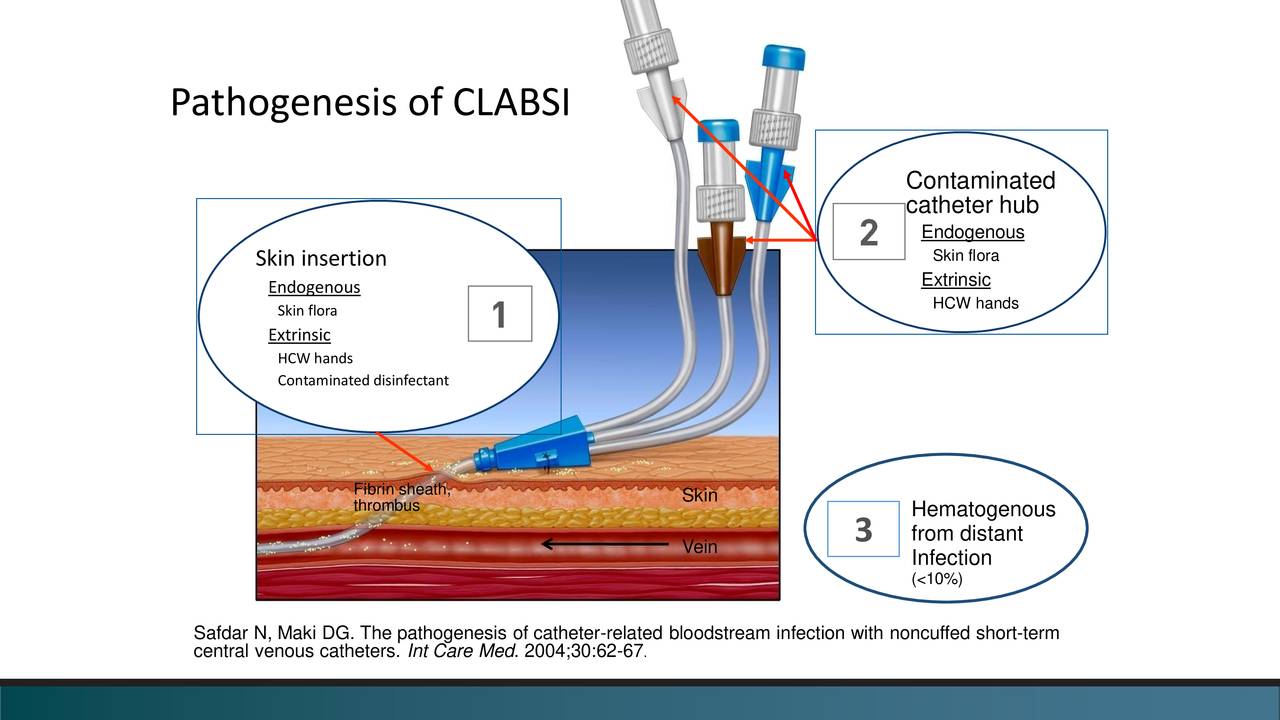 Citius Pharmaceuticals (CTXR) Investor Presentation - Slideshow (NASDAQ ...