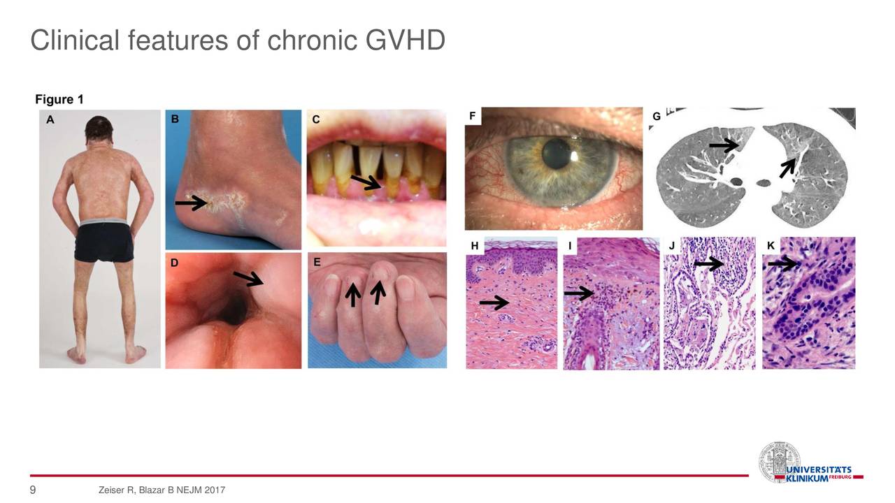 Incyte (INCY) Presents At American Society of Hematology Meeting ...